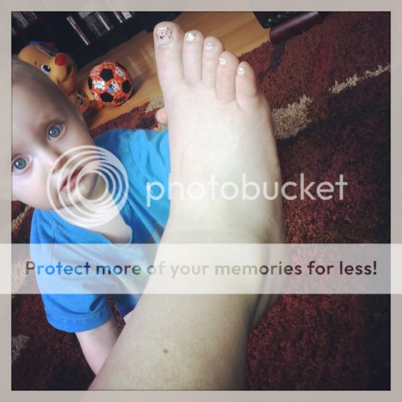 Elephantitis Of The Testicles